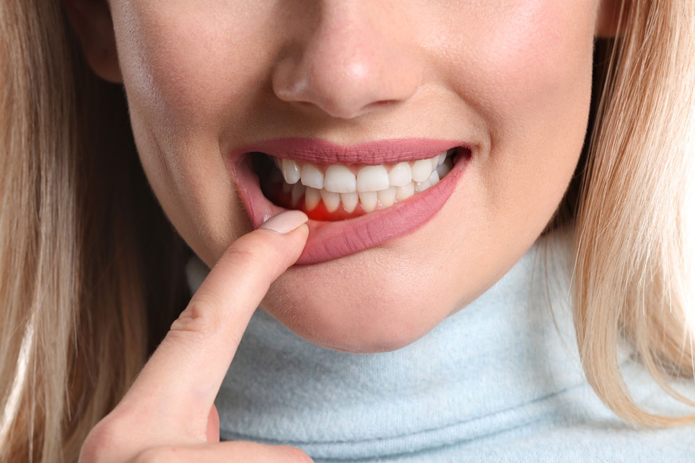 Blasensteine: Ursache, Symptome, Behandlung und Prophylaxe ...